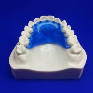 Hawley Retainer – Orthodontist – iHome Dental